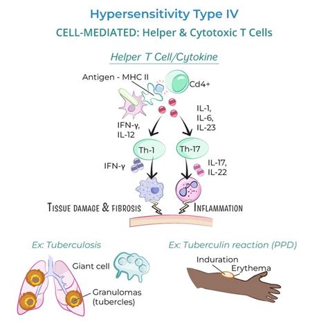 Type Iv Hypersensitivity Type Iv Reactions Are T Cell Mediated Because Of The Time It Takes To