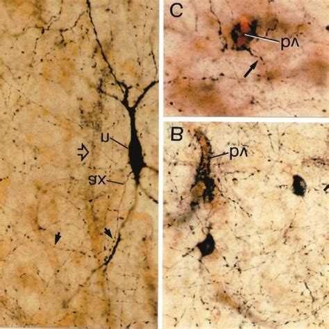 Photomicrographs From The Human Temporal Neocortex Superior Temporal Download Scientific