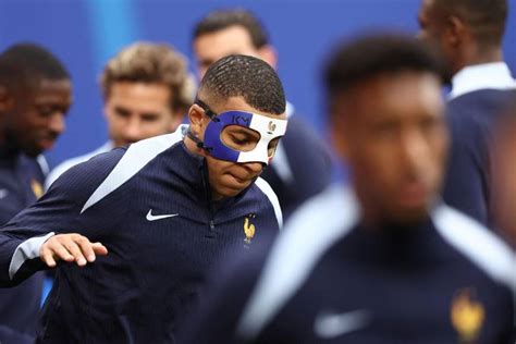 Mbappé Aparece Con Máscara Y Muestra Cómo Le Quedó La Nariz Tras La