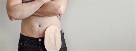What Is The Difference Between An Ostomy And A Colostomy