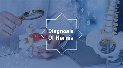Diagnosis Of Hernia Dr Abdulrahman Al Mishari Hospital