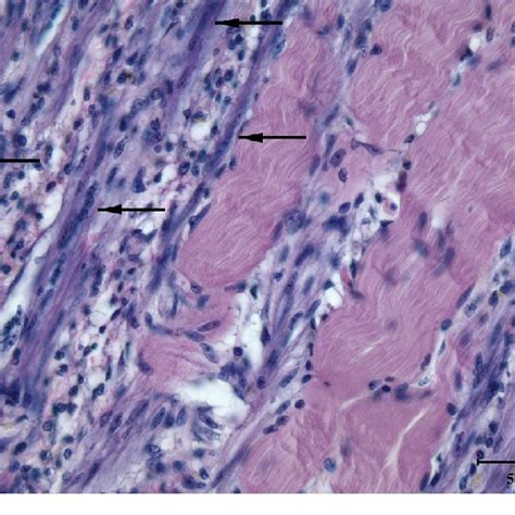 Large Lesion On A Blacktip Shark A Moderately Hyperplastic Epidermis