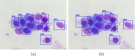 Figure 1 From A Nasal Cytology Dataset For Object Detection And Deep Learning Semantic Scholar