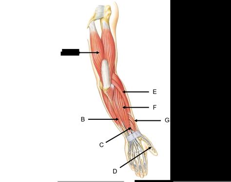 Arm Extensors Quiz