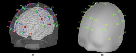 Eeg Brain