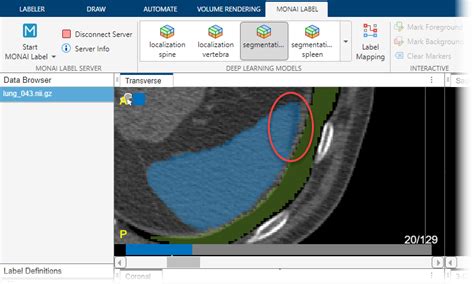 Segment Ct Scan Using Monai Label Matlab And Simulink