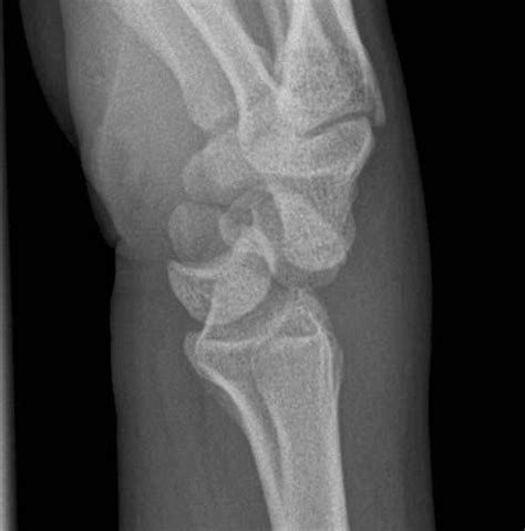 Wrist Radiology Key Wrist Radiology Key