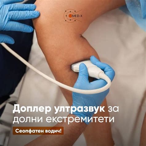 Доплер ехо на долни екстремитети Поликлиника Мед Х