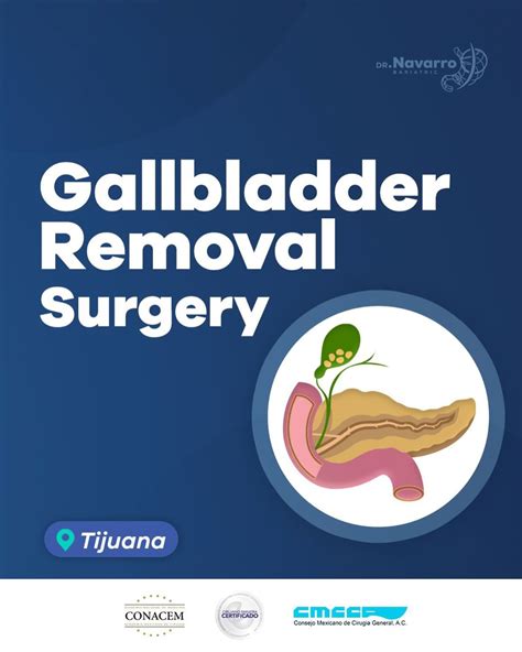 Dr 👉 Gallbladder Removal Surgery Also Known As Cholecystectomy Is A