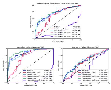 Unsupervised Anomaly Detection Results Using Average 2 Loss Per Scan On
