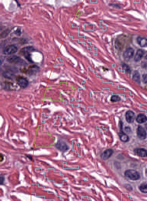 Inconsistency In Annotation Hierarchy Resolution Usage And Issues Imagesc Forum