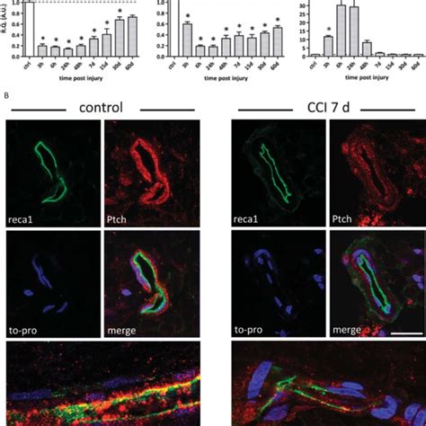 Structure Du Nerf Périphérique Vue Schématique Gauche Et En