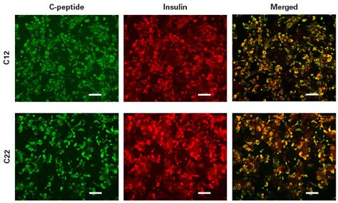 Cellartis Human Ips Cell Derived Beta Cells For Diabetes Drug Discovery