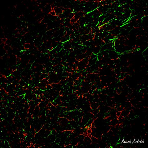 Cells In The Prefrontal Cortex You Can Do It
