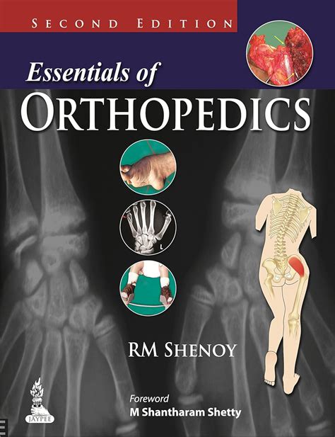 Essentials Of Orthopedics 9789350903735 Medicine And Health Science