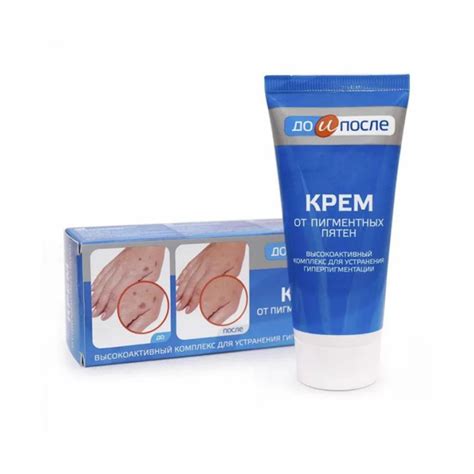 Крем от пигментных пятен 50 мл До и После купить на Ozon по низкой цене 1787808036