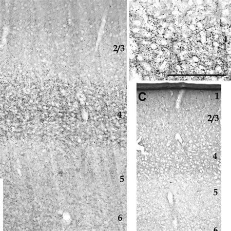 Vglut2 Staining In A Light Micrograph Composite Of Adult And Developing Download Scientific