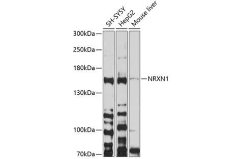 Anti Neurexin 1 Antibody A12776