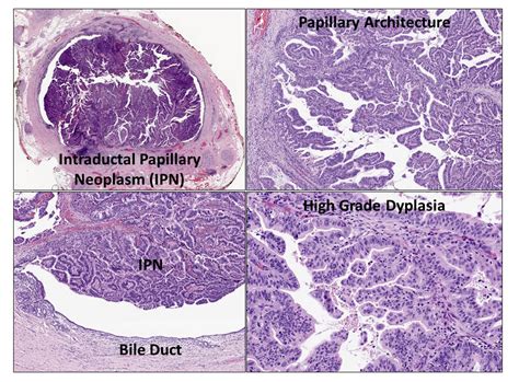 Common Bile Duct Histology