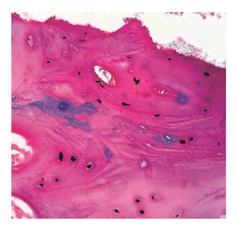 Normal Bone With Active Osteoblasts Producing Osteoid Matrix In The Download Scientific Diagram
