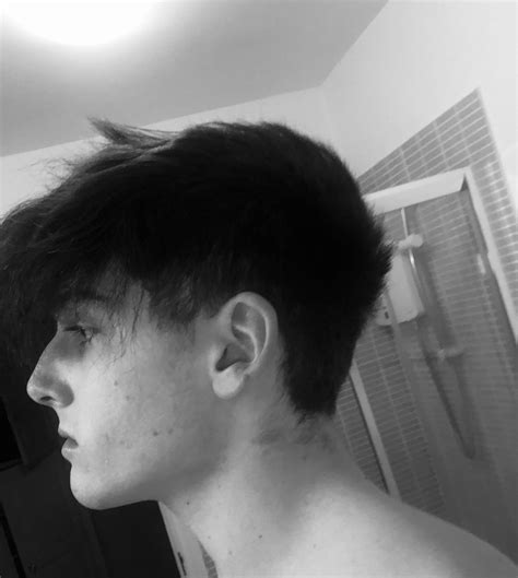 Roman Nose Wondering About A Nose Job But Want To Get Opinions Im