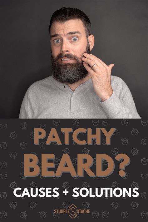 Patchy Beard Patchy Beard Growth And What To Do About It Patchy