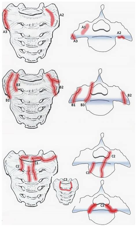 Pre Operative Intraoperative And Post Operative Imaging For Patient Download Scientific