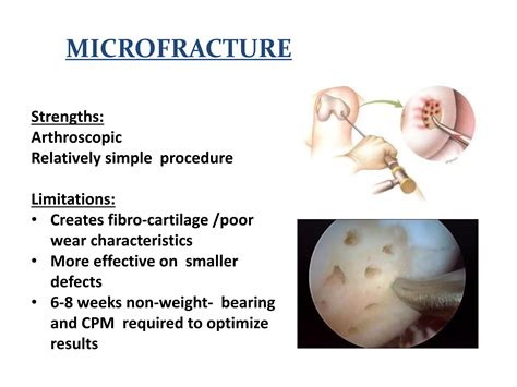 Management Of Cartilage Injuries Pptx Death Injury Or Military