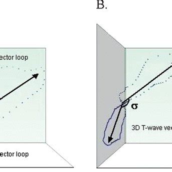 Examples of TCRT in subjects with A high TCRT small θ and B low Download Scientific