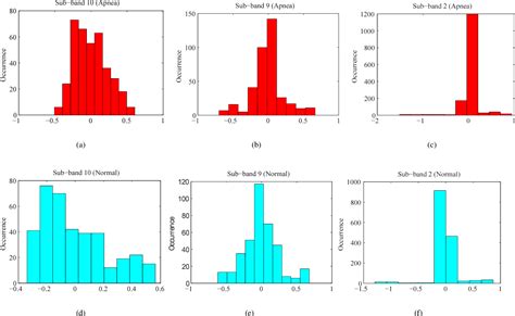 Figure 2 From Computerized Obstructive Sleep Apnea Diagnosis From Single Lead Ecg Signals Using