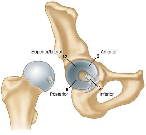 Diagnostic Hip Arthroscopy Radiology Key