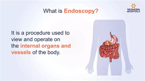 Endoscopy Types Preparation Diagnosis Procedure And Risks Pptx