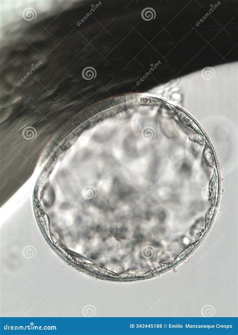 Hatched Human Blastocyst Grade Ba On The Fifth Day Of Development Microscope View Vertical