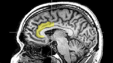 虚拟现实模拟用于中风康复 映维网资讯