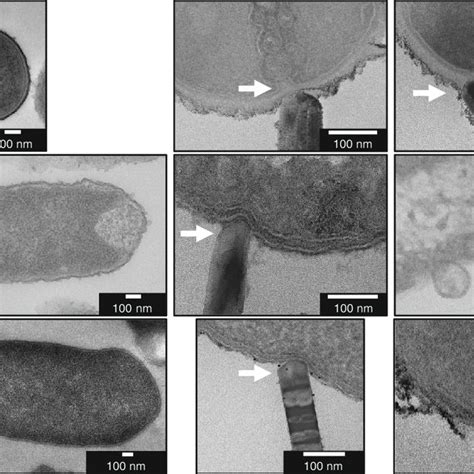 3d Fib Sem Reconstruction Of S Aureus Automated Fib Sem Cross