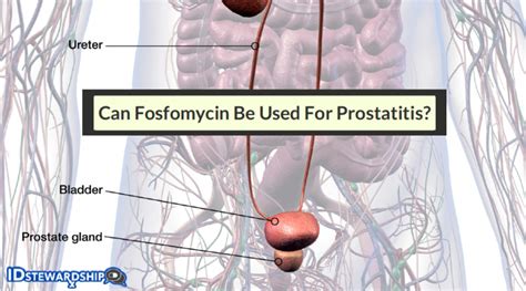 Can Fosfomycin Be Used For Prostatitis