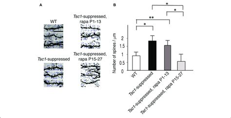 Spine Density Of Basal Dendrites In Electroporated Pyramidal Neurons