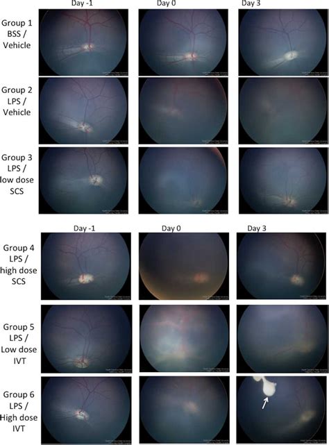 Structure Of Suprachoroidal Space Semantic Scholar