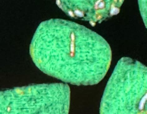 Welcome To DIGITAL Fossil Preparation Fossil Preparation The Fossil Forum