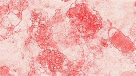 What Are The Symptoms Of Decreasing Platelets