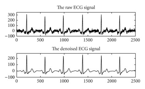Example Of Physiological Signal Ecg Denoising Using The Method Download Scientific Diagram