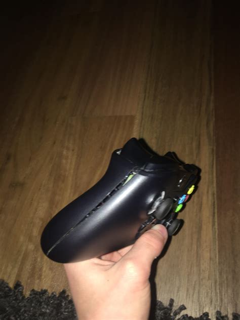 Anyone Know How To Fix This R Xbox