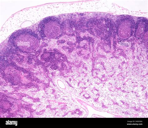 Low Magnification Light Micrograph Of A Lymph Node Showing A Peripheral Dark Cortex And A Large