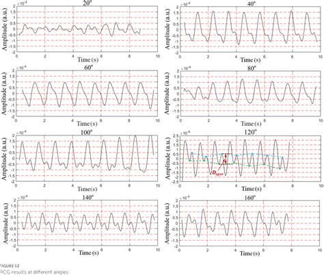 Figure 12 From Contactless Multiscale Measurement Of Cardiac Motion Using Biomedical Radar