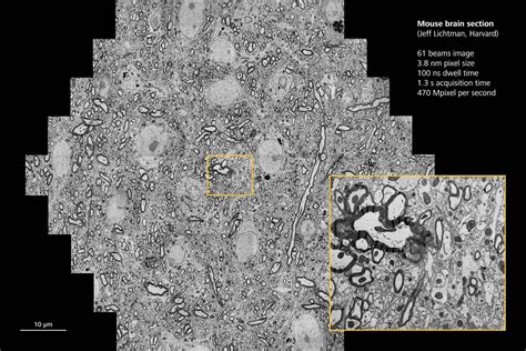 Connectomics Unraveling The Wiring Of Neural Networks