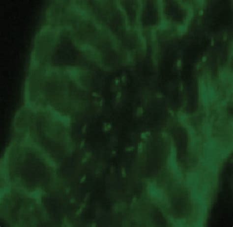 Specific Detection Of Clarithromycin Sensitive And Download