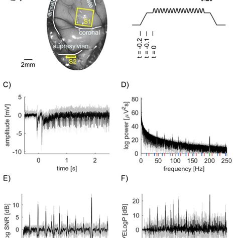 Neural Recording Vibratory Stimulation And Our Analysis Scheme 856