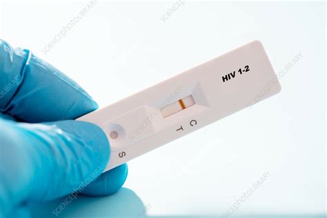 Negative Hiv Rapid Test Conceptual Image Stock Image F036 9711 Science Photo Library