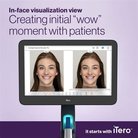 In Face Visualization Observa Tu Nueva Sonrisa En Tu Cara Invisalign En Ciudad De México