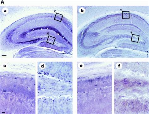 Immunohistochemical Analysis Of Hippocampus In A Wild Type A C D Download Scientific